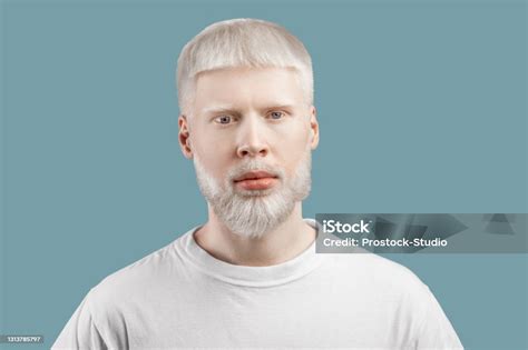 청록색 스튜디오 배경에서 포즈를 취하는 티셔츠를 입은 알비노 남자의 초상화 특이한 외관 피부 이상 개념 20 29세에 대한 스톡