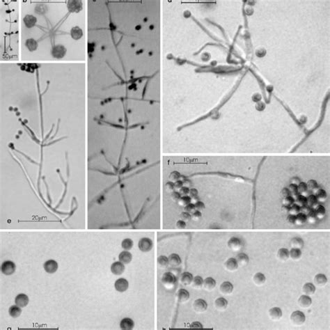 Pochonia Globispora A C F Conidiophores And Phialides B Berry Like