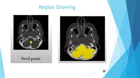 Basic Principles Of Image Segmentation In Medical Imagespptx
