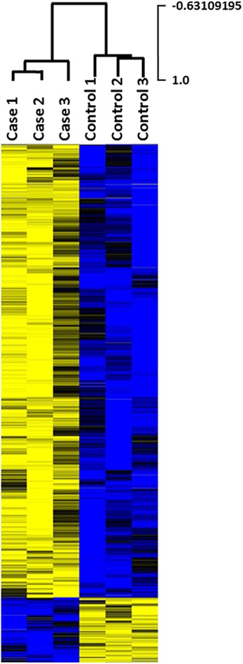 Heat Map Of 1642 Alternative Splicing Events Hierarchical Cluster