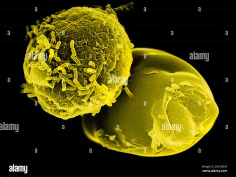 Scanning Electron Micrograph Sem Tinted Green Of The Bacteria Agrobacterium Tumifaciens