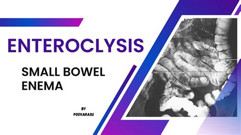 Enteroclysis Procedure In Radiology Department Pdf