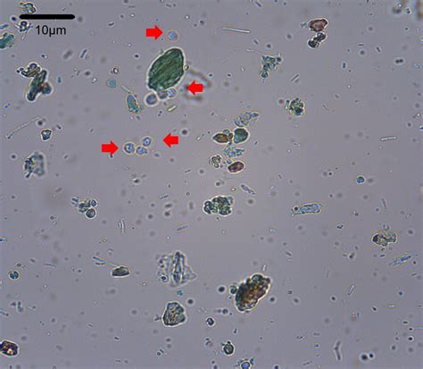 Cryptosporidium Parvum Microscope