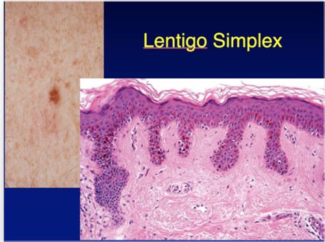 Skin Path I Flashcards Quizlet