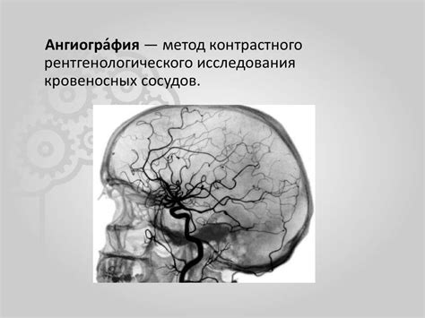 Ангиография в неврологии - online presentation
