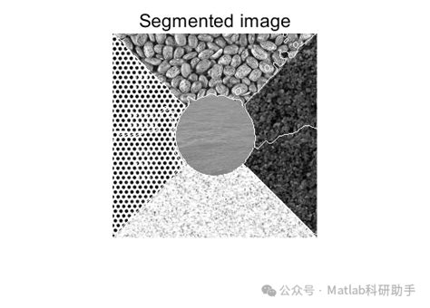 【图像处理】基于小波编码图像中伪影和纹理的检测附matlab代码 小波增强伪影 csdn博客