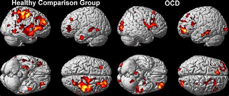 Event Related Functional Magnetic Resonance Imaging Of Response