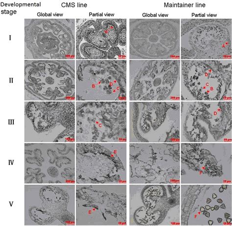 Microspore Development Of The Pepper Anther Cms Line And The Maintainer Download Scientific