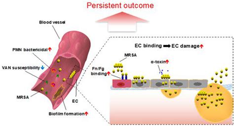 Antibiotic Resistant Staphylococcus Aureus