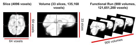 Beginners Guide To Fmri Preprocessing — Sotnir Handbook 010 Documentation