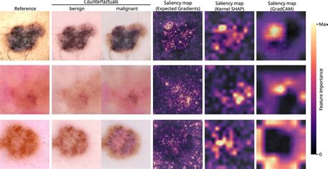 Comparison Of Insights From Counterfactuals And Saliency Maps We Download Scientific Diagram