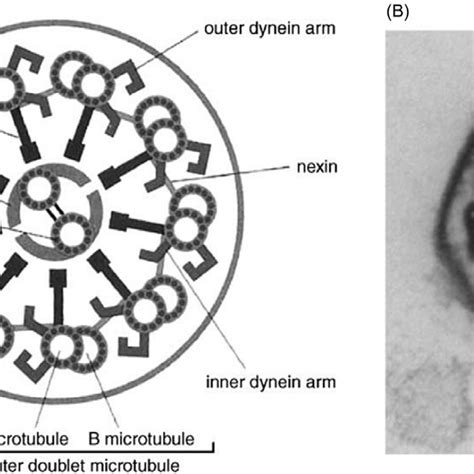 A Cartoon Of Normal Ciliary Ultrastructure B Electron Micrograph