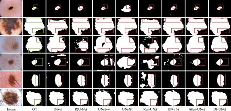 Visual Comparison On Some Representative And Challenging Images On The