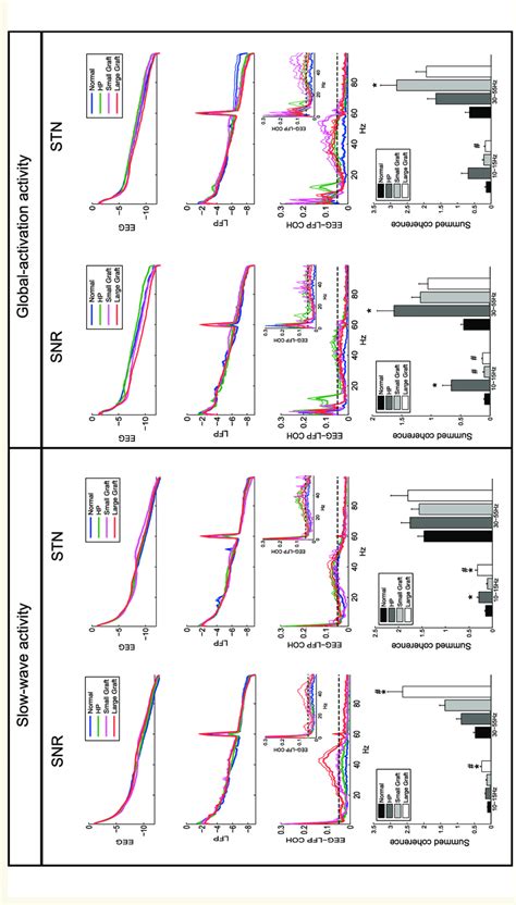 Spectral Measures Top Row Mean Eeg Log Spectra Bold Lines And Sem