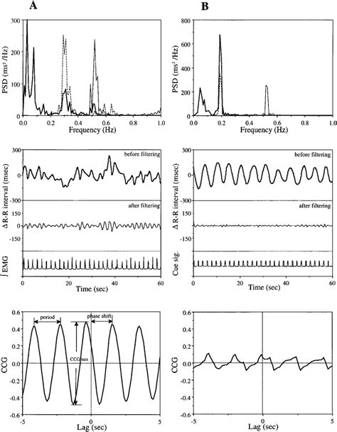 A Top Fourier Spectra Of Time Series Of R R Interval Rri Thick