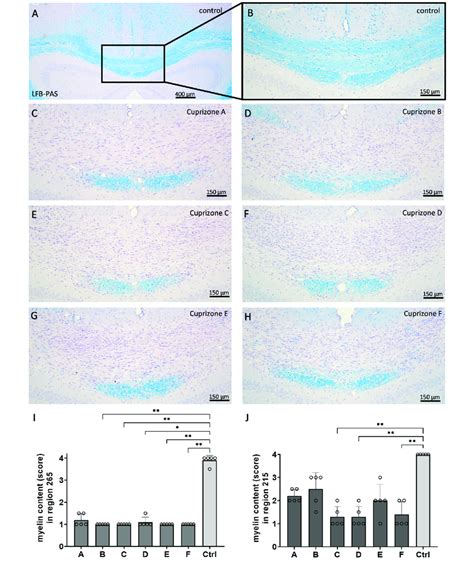 Cuprizone Induced Demyelination Analyzed By Lfb Pas Staining A H