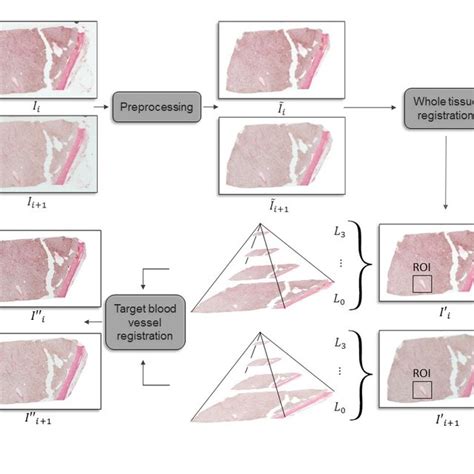 The Diagram Shows An Overview Of The Proposed Algorithm For Regional Download Scientific