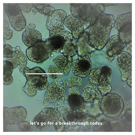 Erin Borkowski Posted On Linkedin