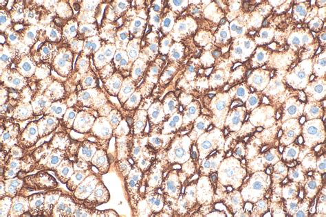Icam 1cd54 Antibody 30324 1 Ap Proteintech