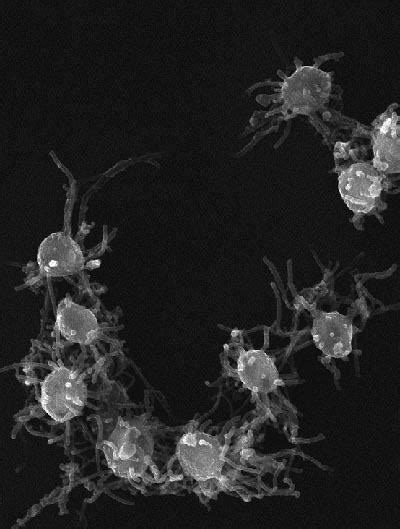 Capsaspora ~ Detailed Information Photos Videos