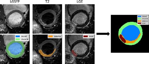 Deep Gaussian Mixture Model For Unsupervised Image Segmentation