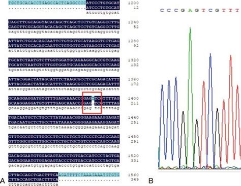 A Sequence Of The Cds Region In Exon 9 Of Eif2ak4 B The C 1392delt Download Scientific