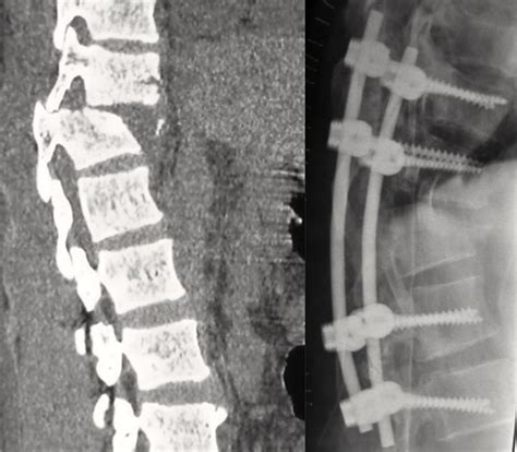 Procedimientos en Neurocirugia