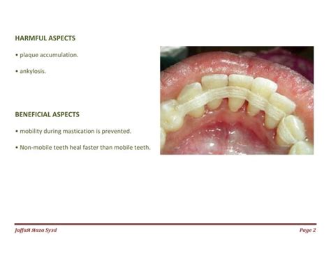039 Splints In Periodontal Therapy Pdf Physical Therapy Wellness