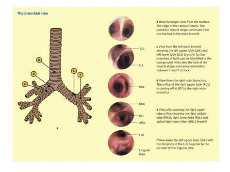 Fibre Optic Bronchoscopy Pptx