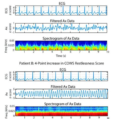 spectral analysis of accelerometer waveforms extracted from 10−s
