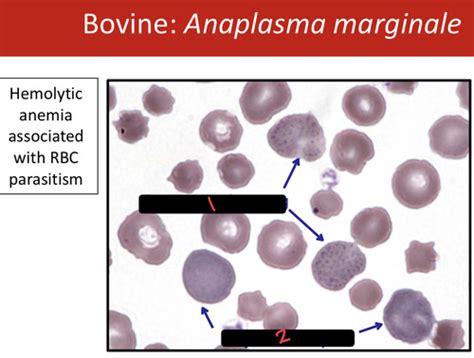 Anemia Regenerative Vs Nonregenerative Part 1 Flashcards Quizlet