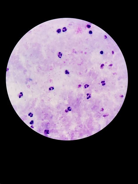 malaria annotations object detection dataset by leonardo moretti