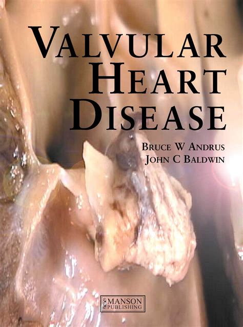 Valvular Heart Disease Εκδόσεις Κωνσταντάρας