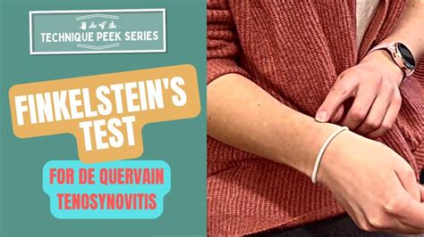 How To Perform The Finkelsteins Test For De Quervains Tenosynovitis