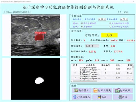 基于深度学习的乳腺癌智能检测分割与诊断系统【python源码pyqt5界面数据集训练代码】深度学习实战、目标分割、人工智能癌症识别系统