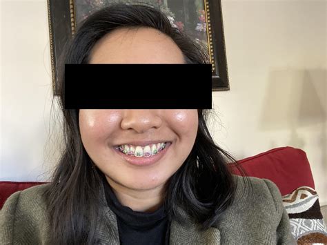 Pink And Green Braces