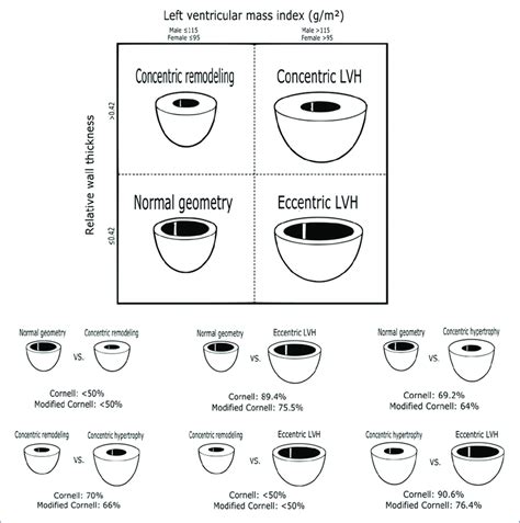 Left Ventricular Geometries And Accuracy Of The Cornell And Modified