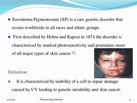 Xeroderma Pigmentosum Xeroderma Pigmentosum