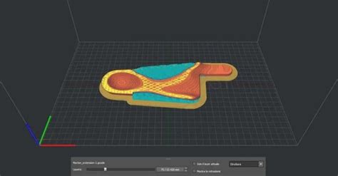 3d Printed Orthopedic Insoles 3d Tech Valley
