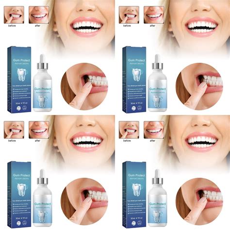 30ml Super Strong Oral Care Solution Effective In Removing And