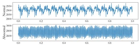 Fractal Fract Free Full Text Fault Diagnosis Of Hydroelectric Units