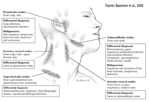 Manejo Del Cuello En El Cáncer De Laringe Gaes Orl Guide
