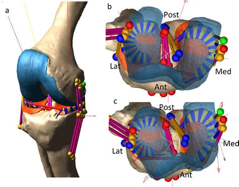 Figure 1 From Loading Of The Medial Meniscus In The Acl Deficient Knee A Multibody