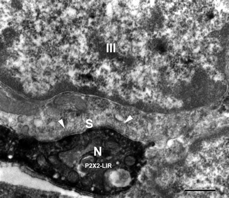 A DAB Immunoelectron Image Showing A Type III Cell III With A Download Scientific Diagram