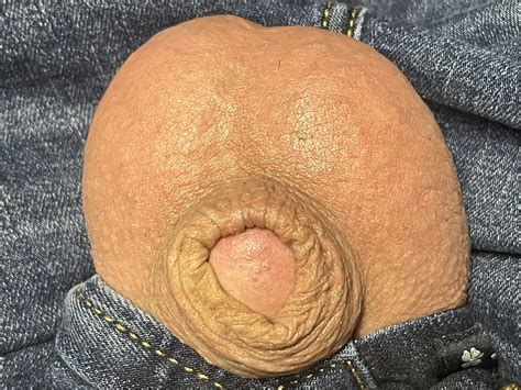Tiny Inverted Cock 17 Pics Xhamster