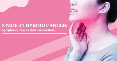 Stage 4 Thyroid Cancer Dr Mark Dandrea Medium