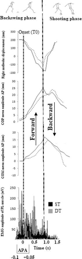Analysis Of Coordination Posture Movement On Dual Task Condition