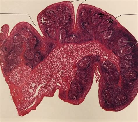Lymphatic System Microscope Slides Flashcards Quizlet