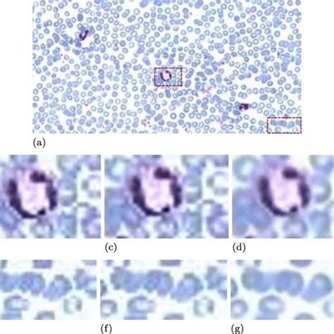 A Super Resolution Result Of Applying The Dataset 2 Trained Deep Cnns Download Scientific