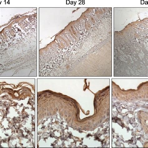 Immunohistochemical Staining Of Transforming Growth Factor β1 In Normal Download Scientific